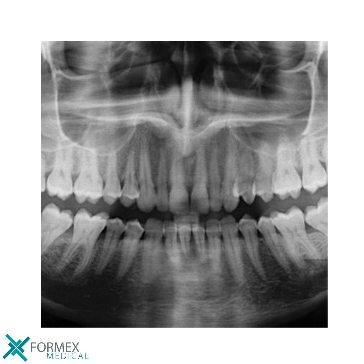 Medische Apparatuur: Formex Medical X-Ray Reader